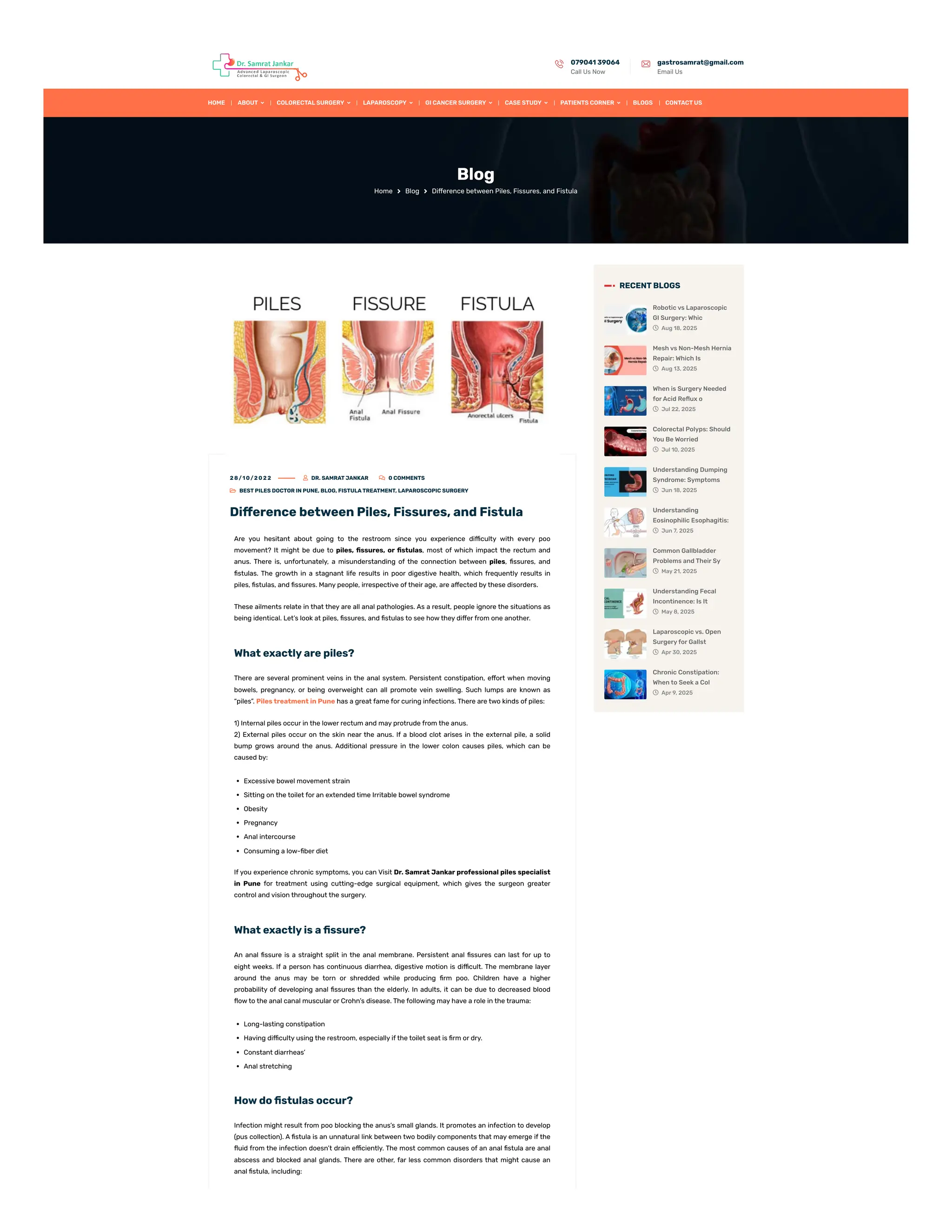 Difference between Piles, Fissures, and Fistula | PDF