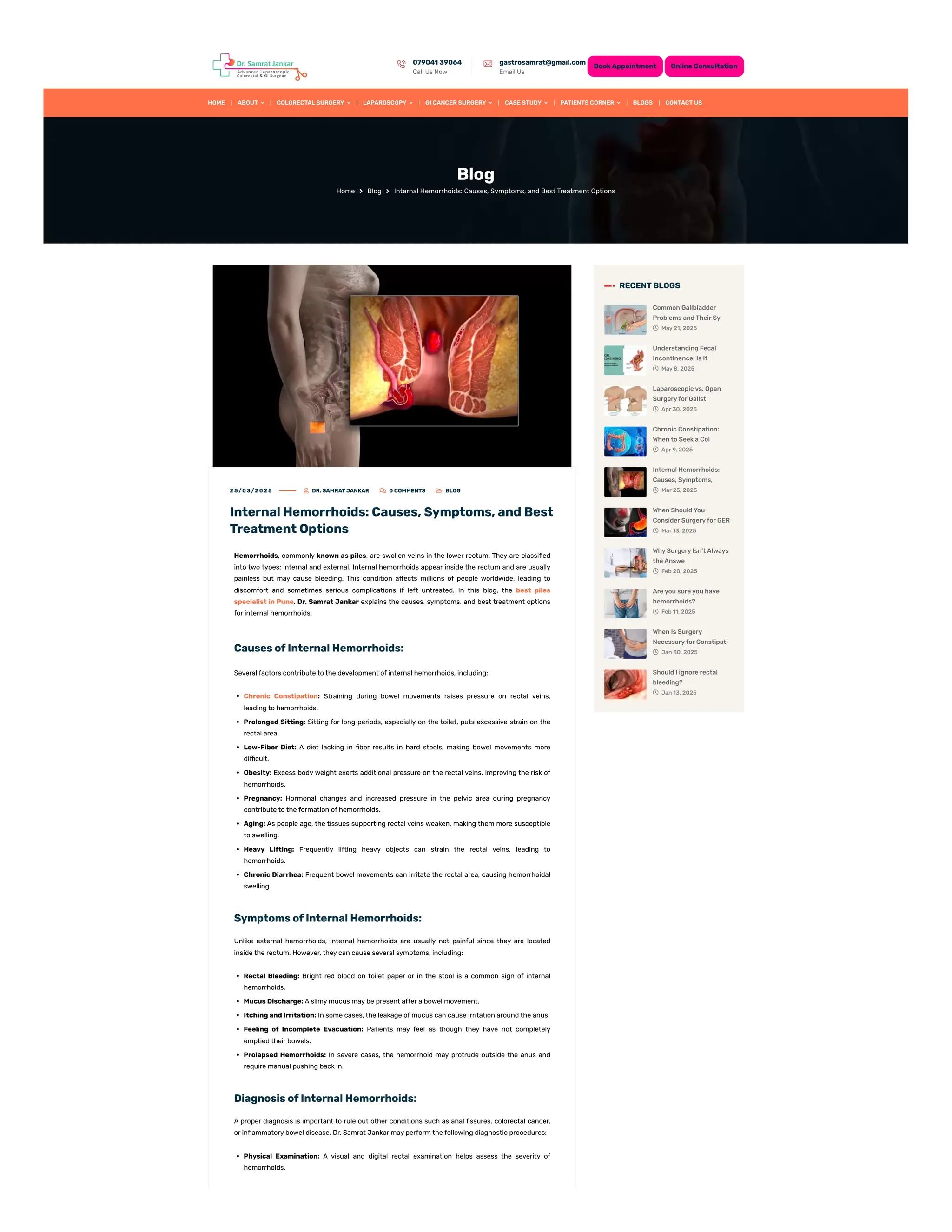 Internal Hemorrhoids: Causes, Symptoms, and Best Treatment Options | PDF