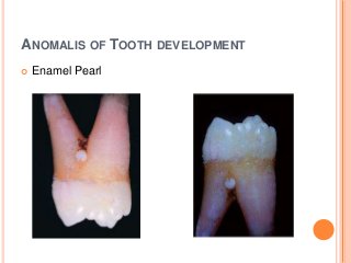 Tooth development part 2 | PPTX