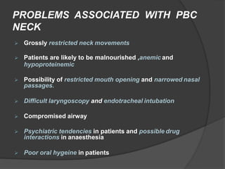 neck_contracture.pptx