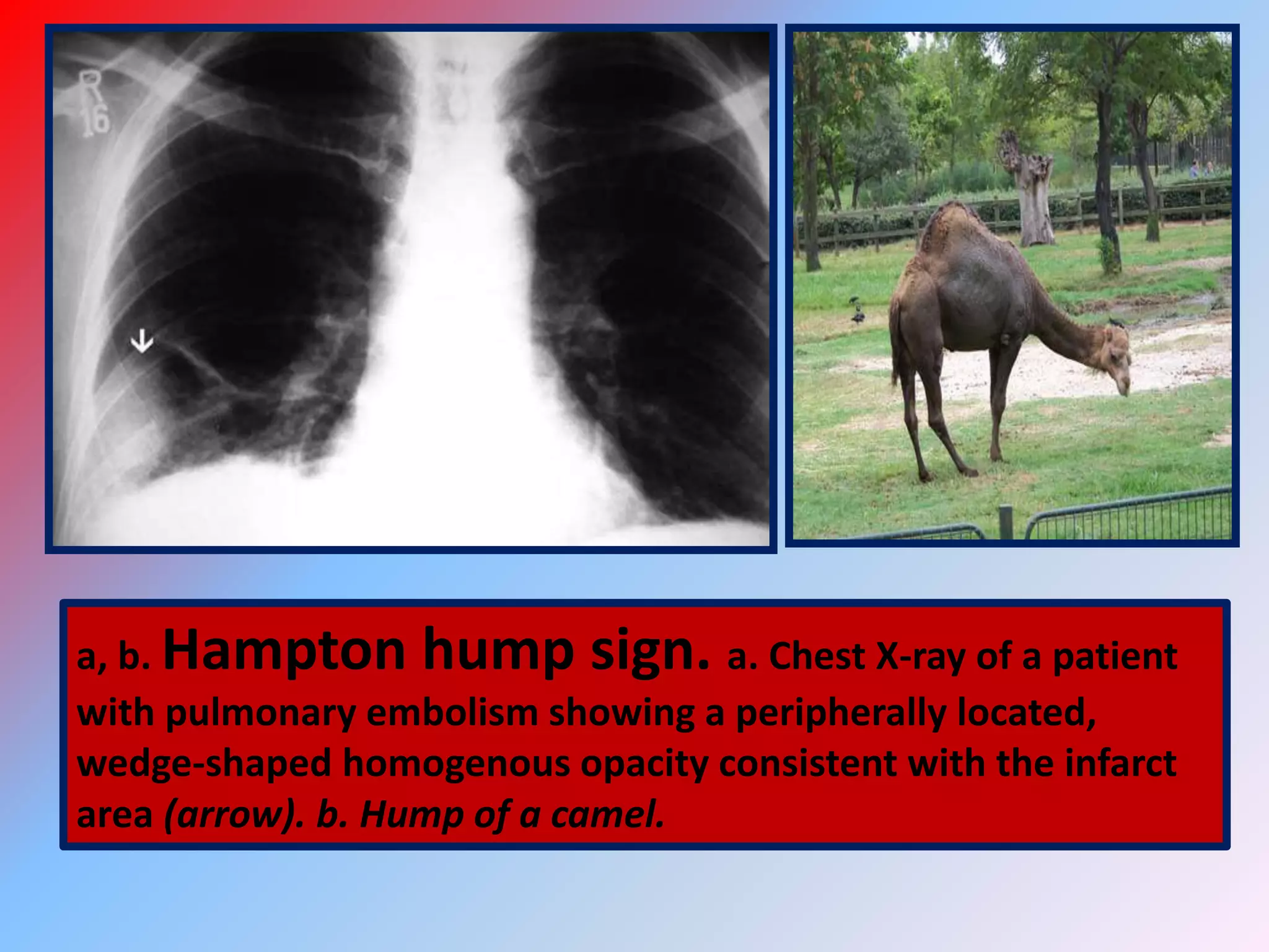 X.ray pearls 1 | PPTX