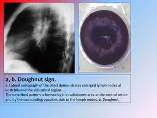 X.ray pearls 1 | PPTX