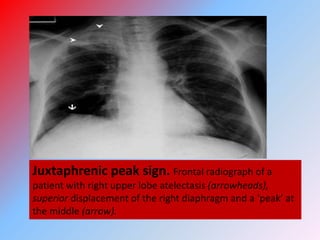 X.ray pearls 1 | PPTX