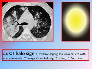 X.ray pearls 1 | PPTX