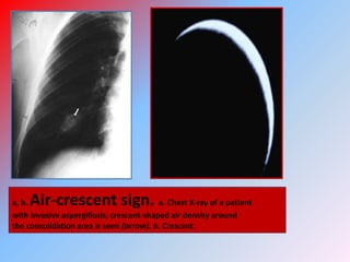 X.ray pearls 1 | PPTX