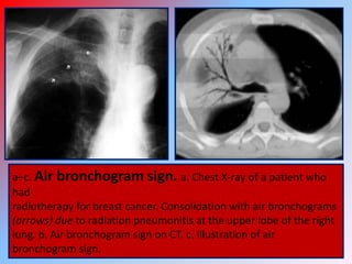 X.ray pearls 1 | PPTX