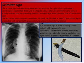 X.ray pearls 1 | PPTX