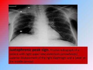 X.ray pearls 1 | PPTX