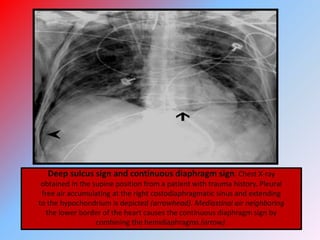 X.ray pearls 1 | PPT