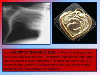 X.ray pearls 1 | PPT