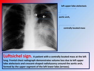 X.ray pearls 1 | PPTX