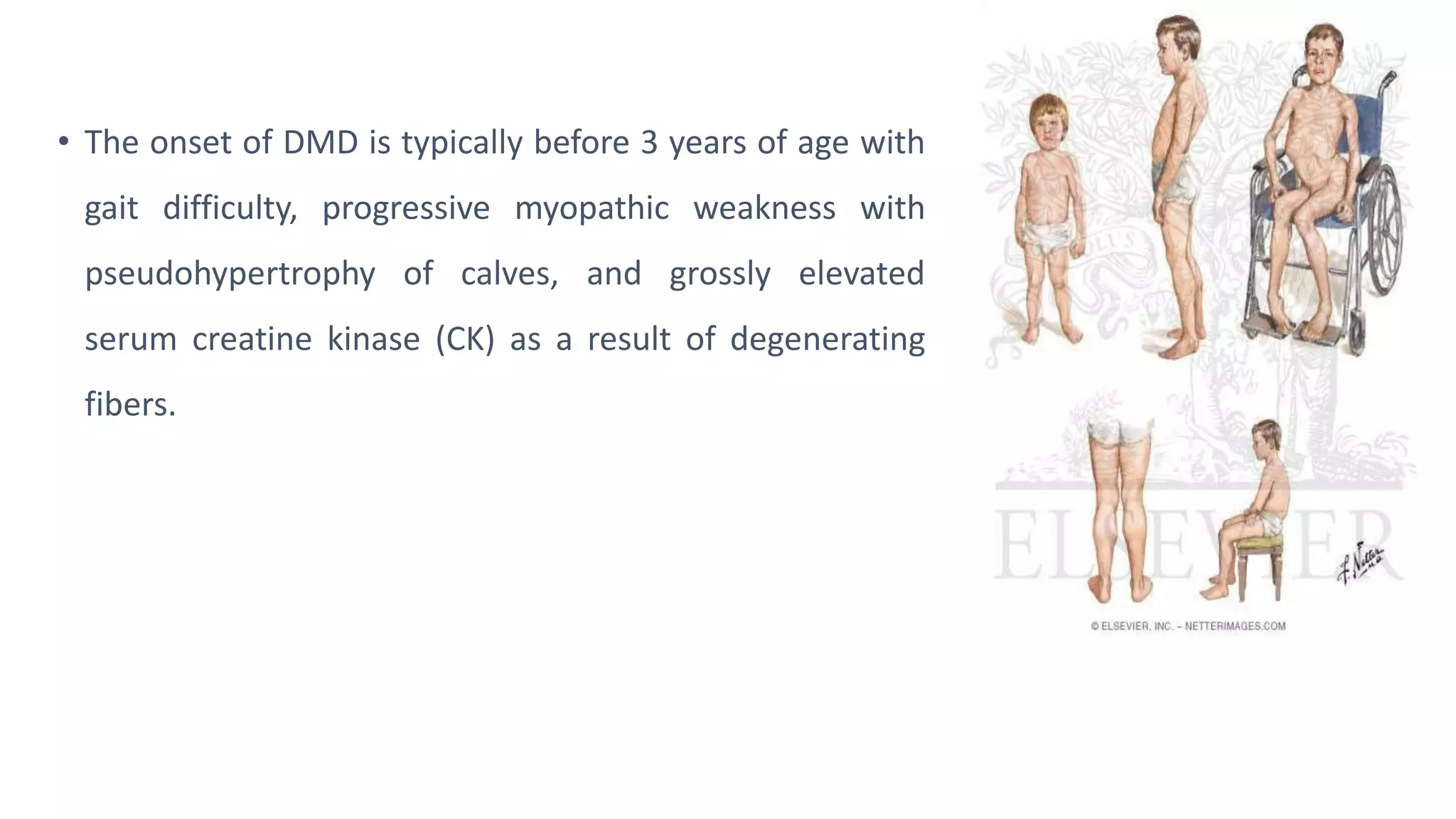 X linked diseases-mitochondrial diseases | PPTX