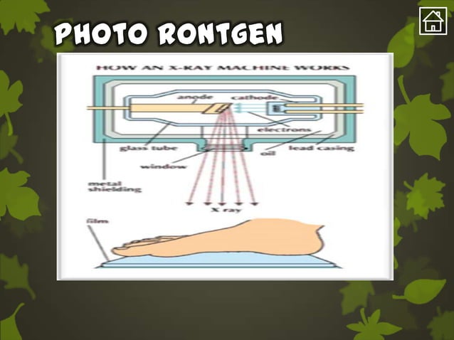 X ray | PPT