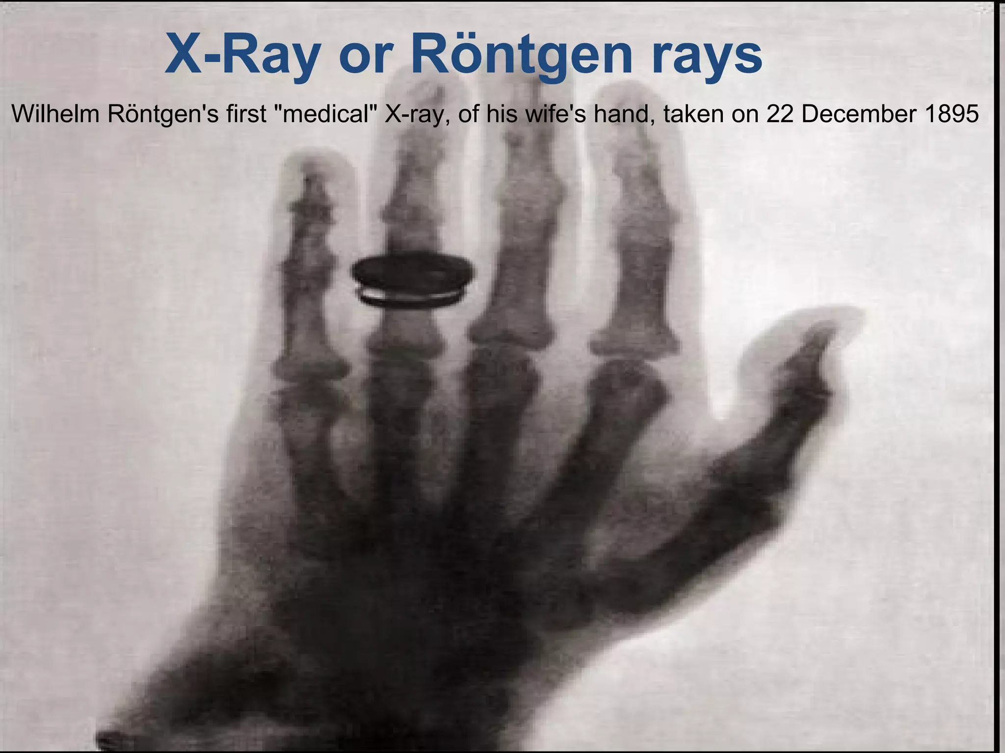 X ray | PPT