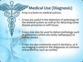 X ray | PPT