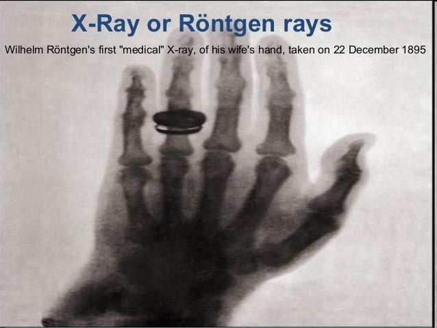 X ray