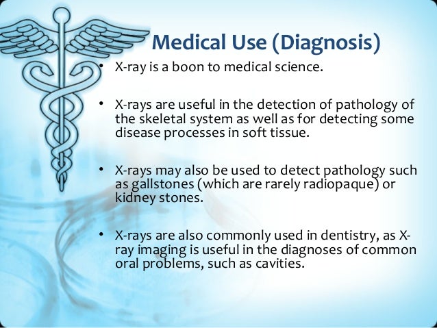 Xrays Definition Of Xrays By Medical Dictionary