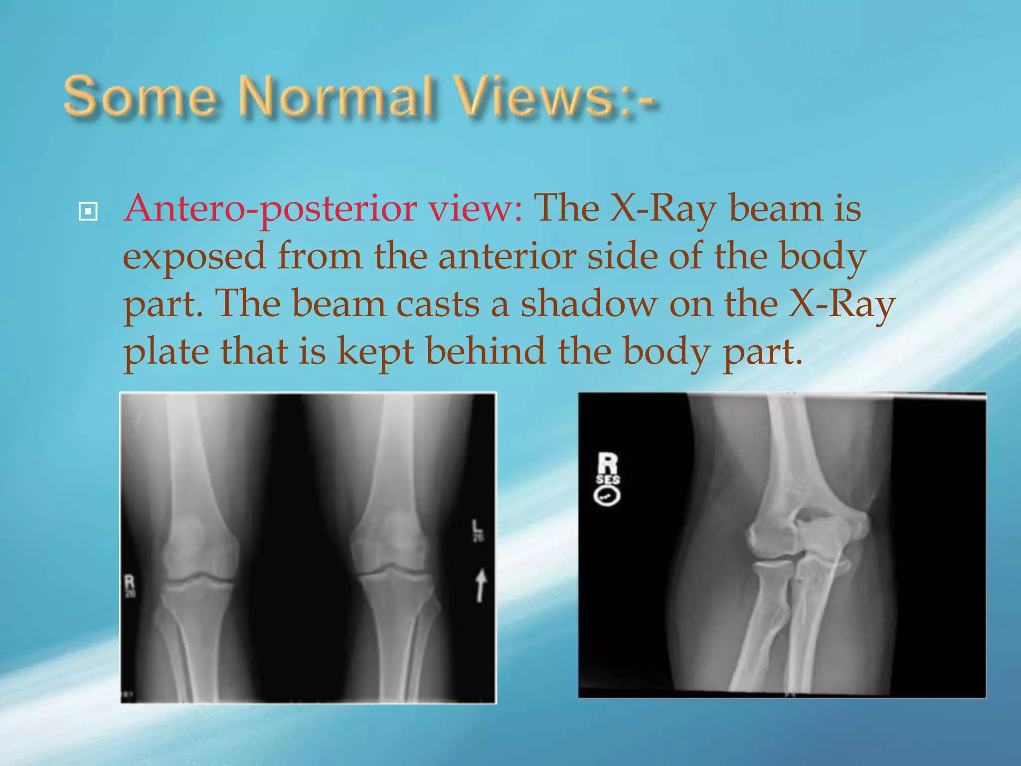 X-Ray | PPTX