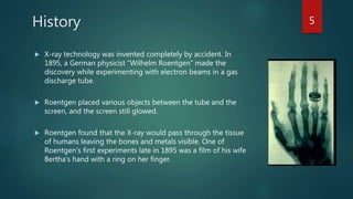 X ray | PPTX | Medical Tests | Medical Health