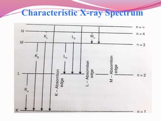 X ray | PPTX