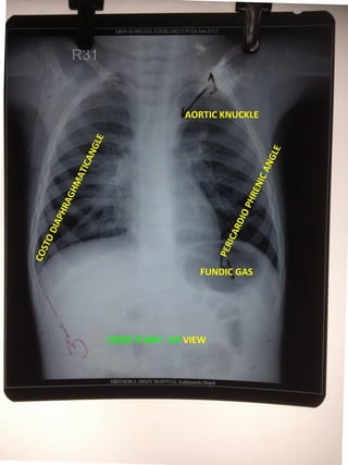 X-Rays | PDF