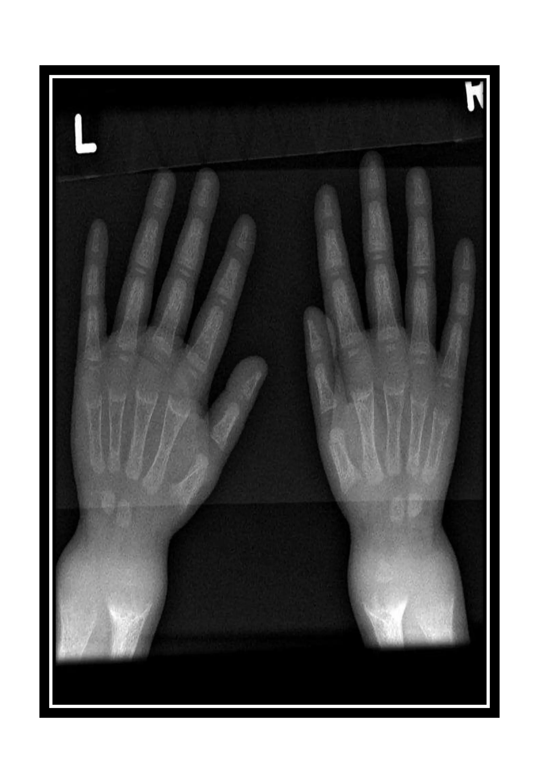 X-RAY-BASICS.pediatrics.medical collegeppt | PPT