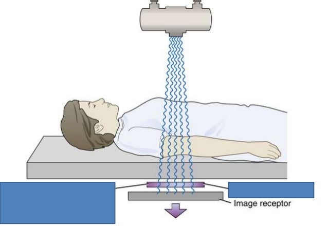 X ray-beam-and-image-formation