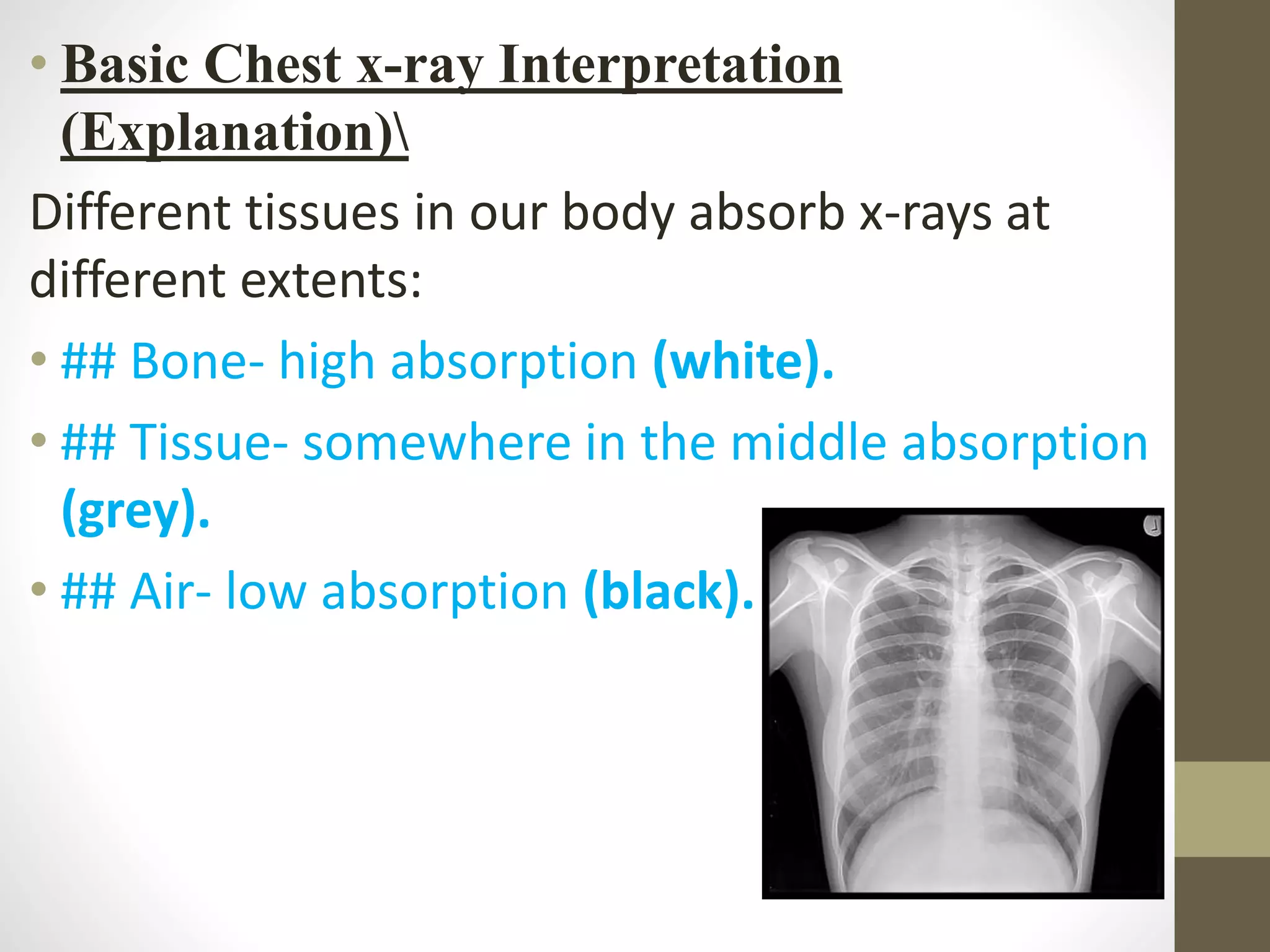 x-ray-lecture-1-1.pptx