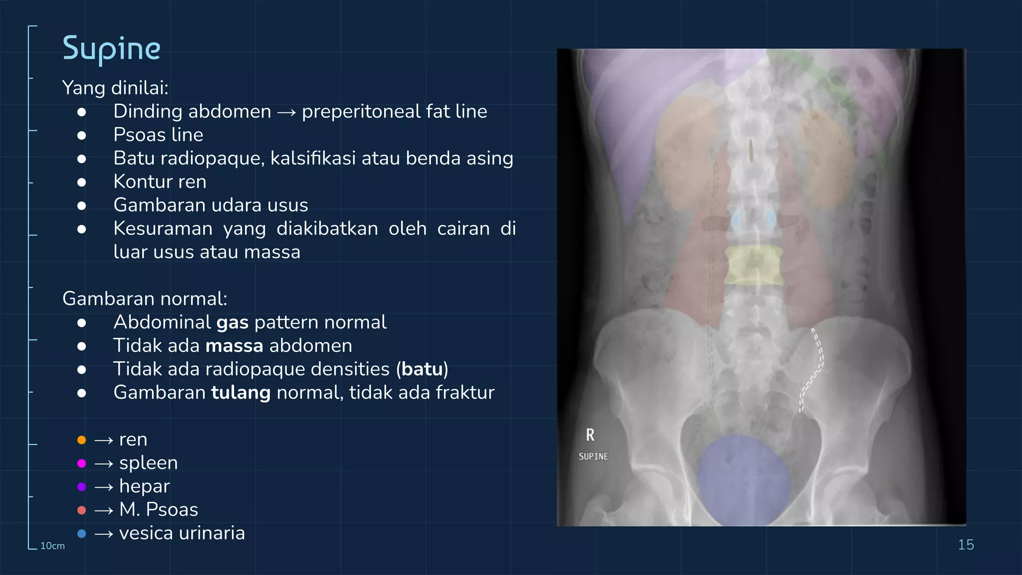 X-Ray Abdomen Lena.pdf