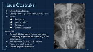 X-Ray Abdomen Lena.pdf
