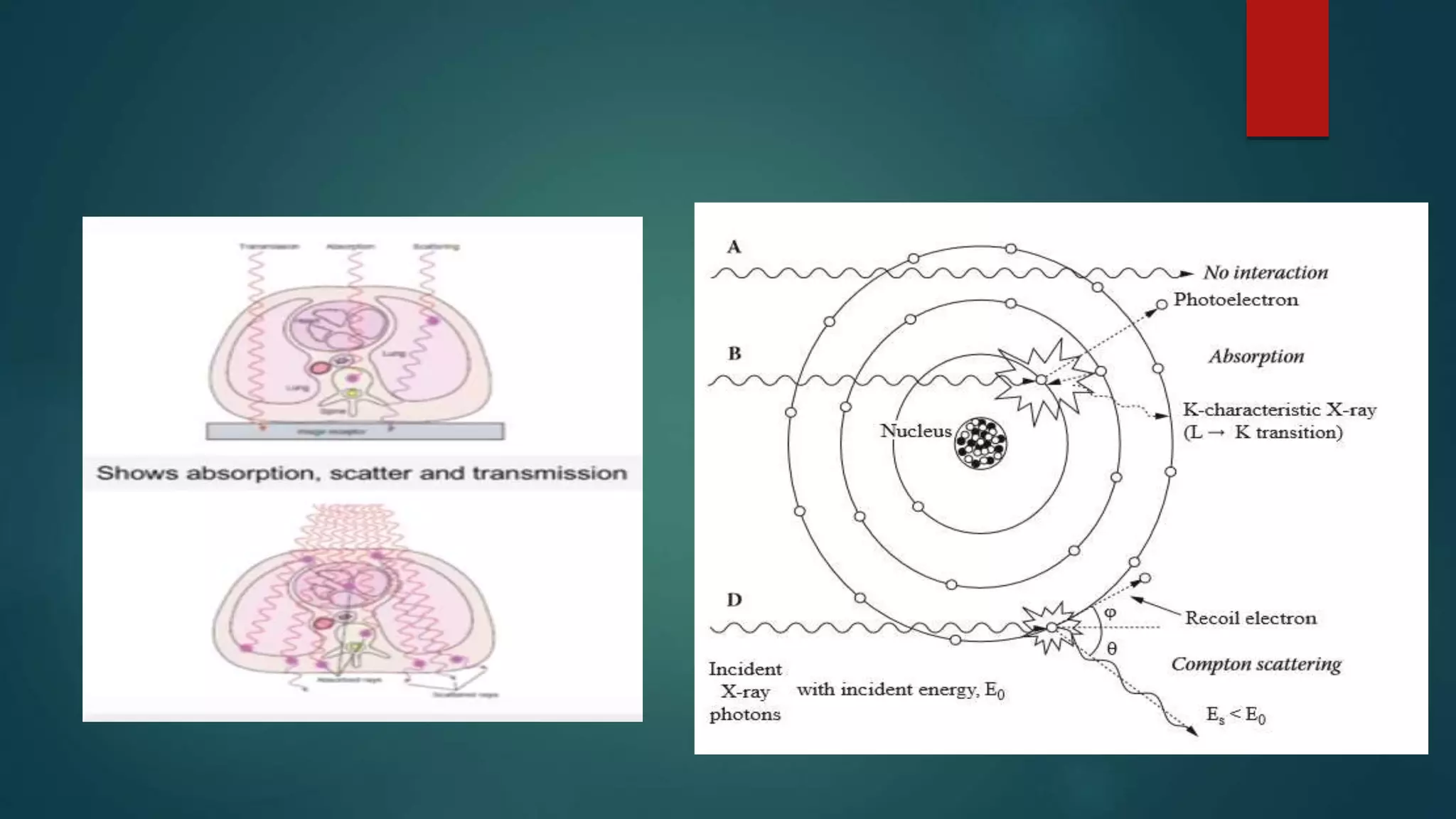 X ray attenuation & law of exponential attenuation | PPTX