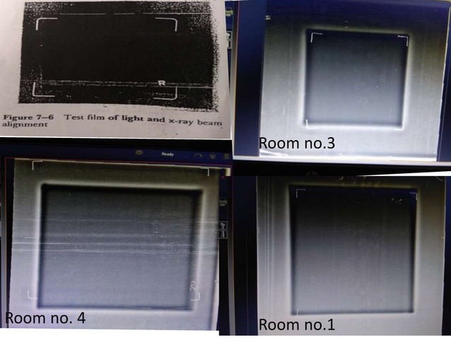 X ray beam rest | PPTX