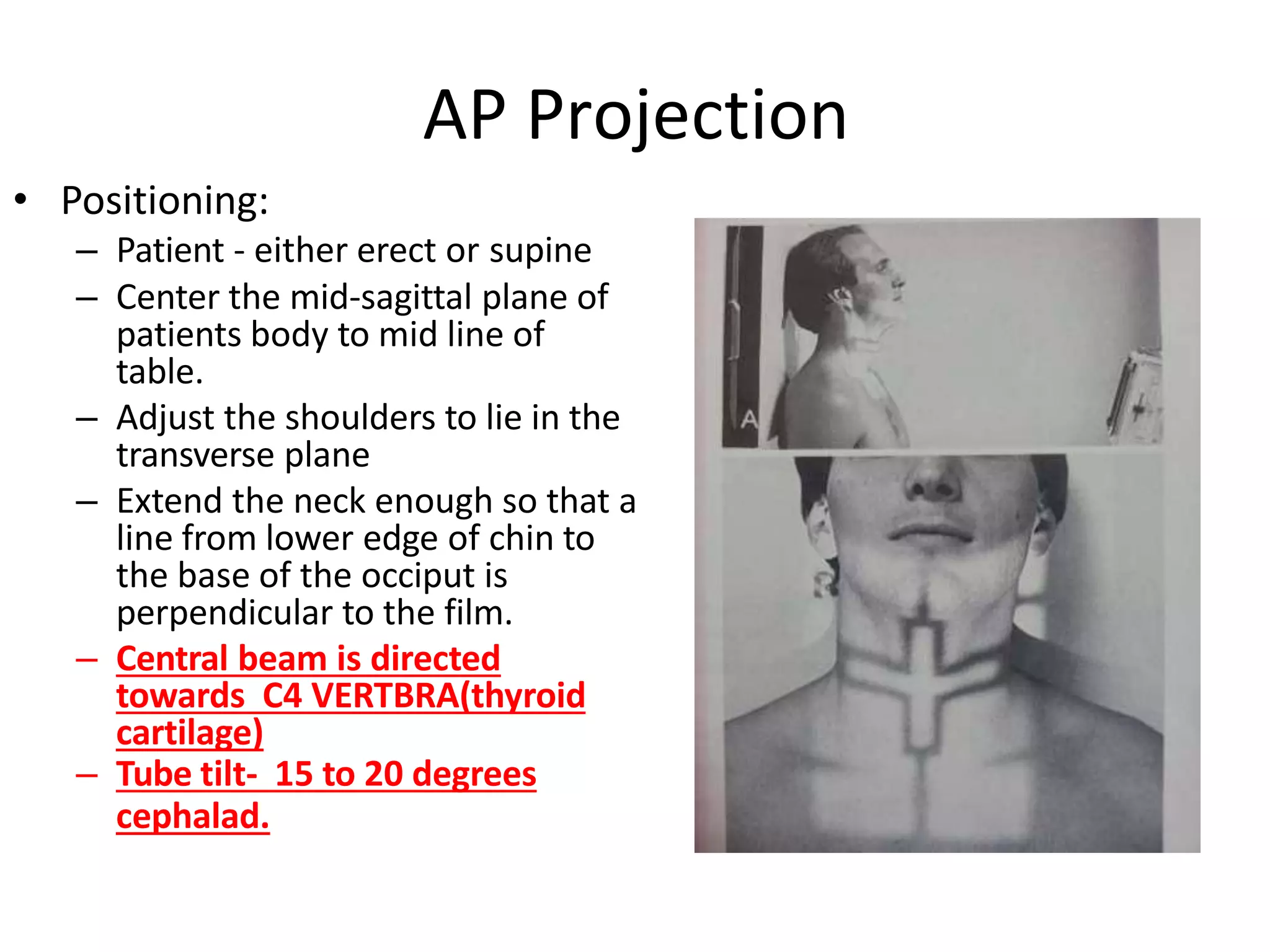 X ray c-spine | PPTX