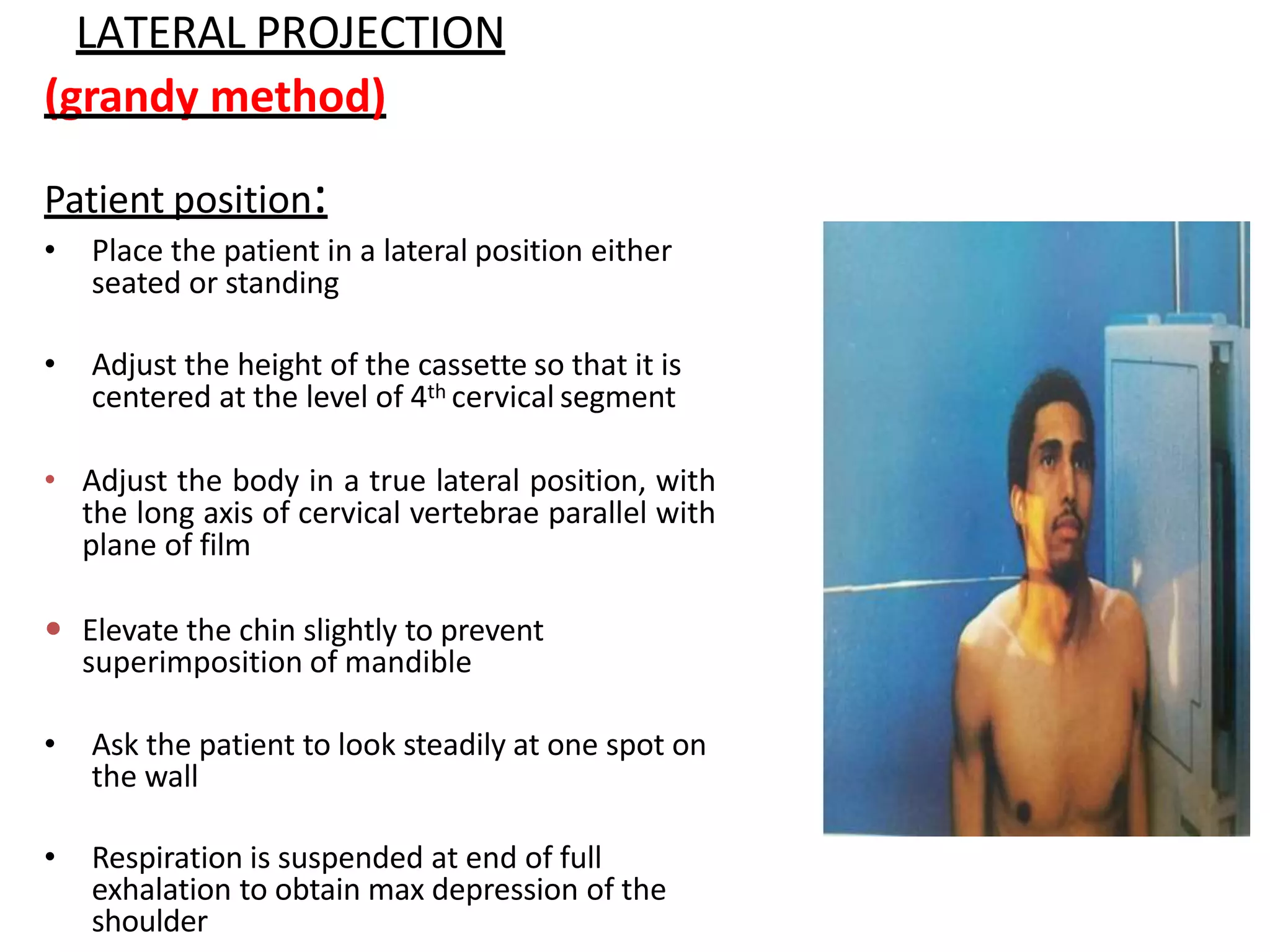 X ray c-spine | PPTX