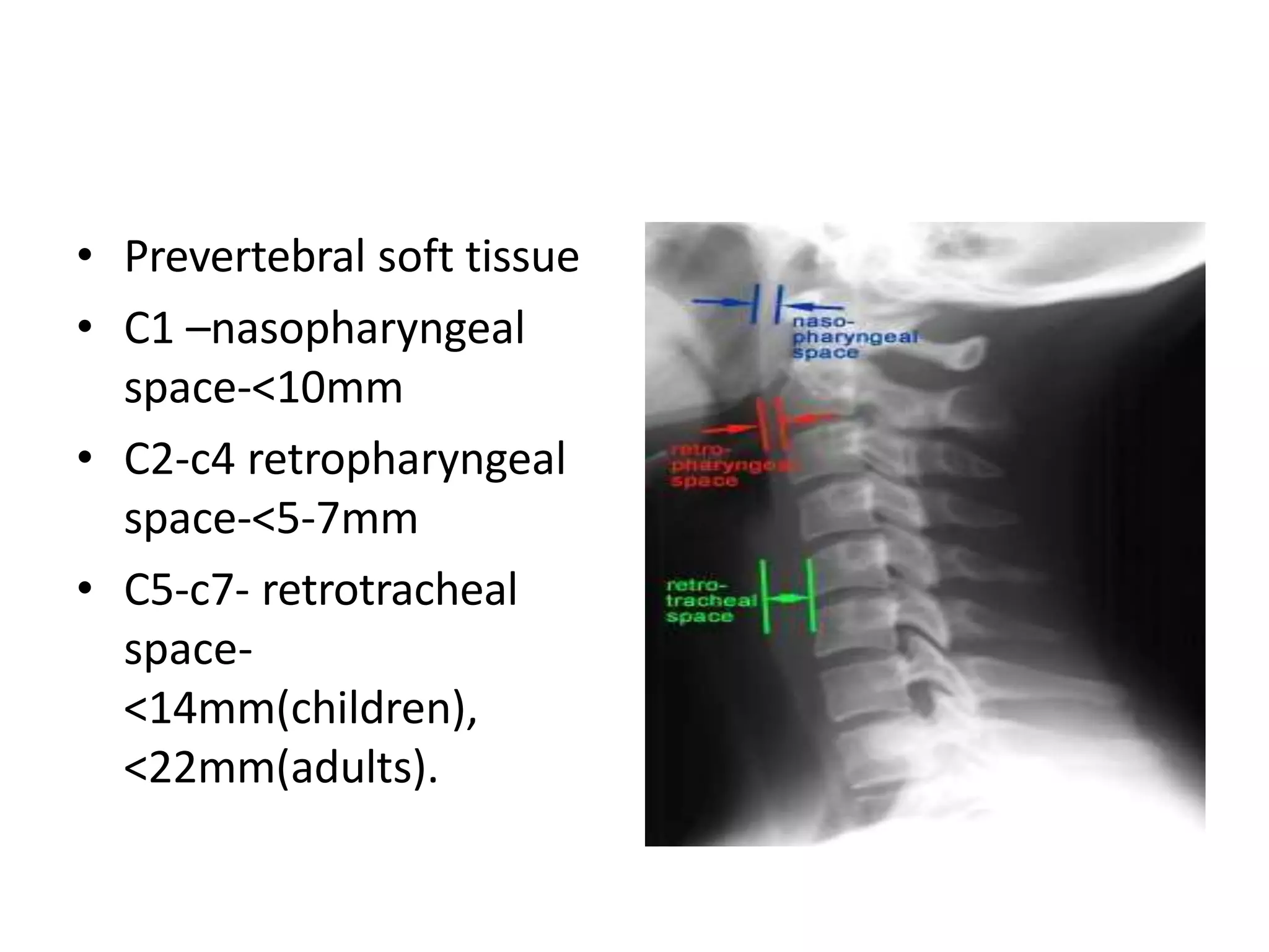 X ray c-spine | PPTX