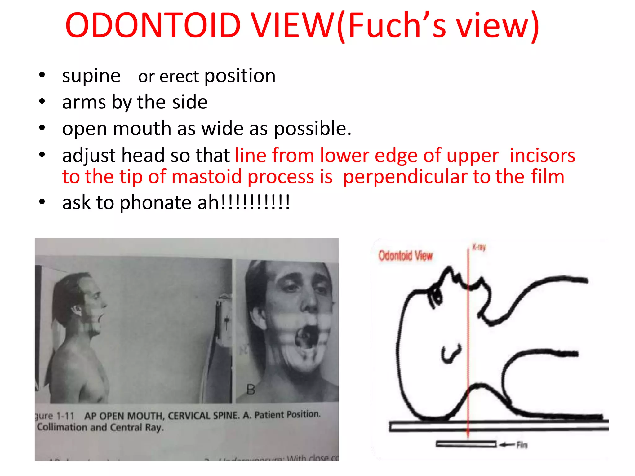 X ray c-spine | PPTX