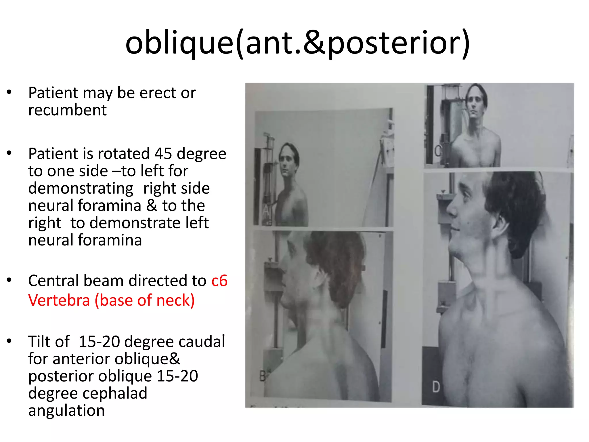X ray c-spine | PPTX