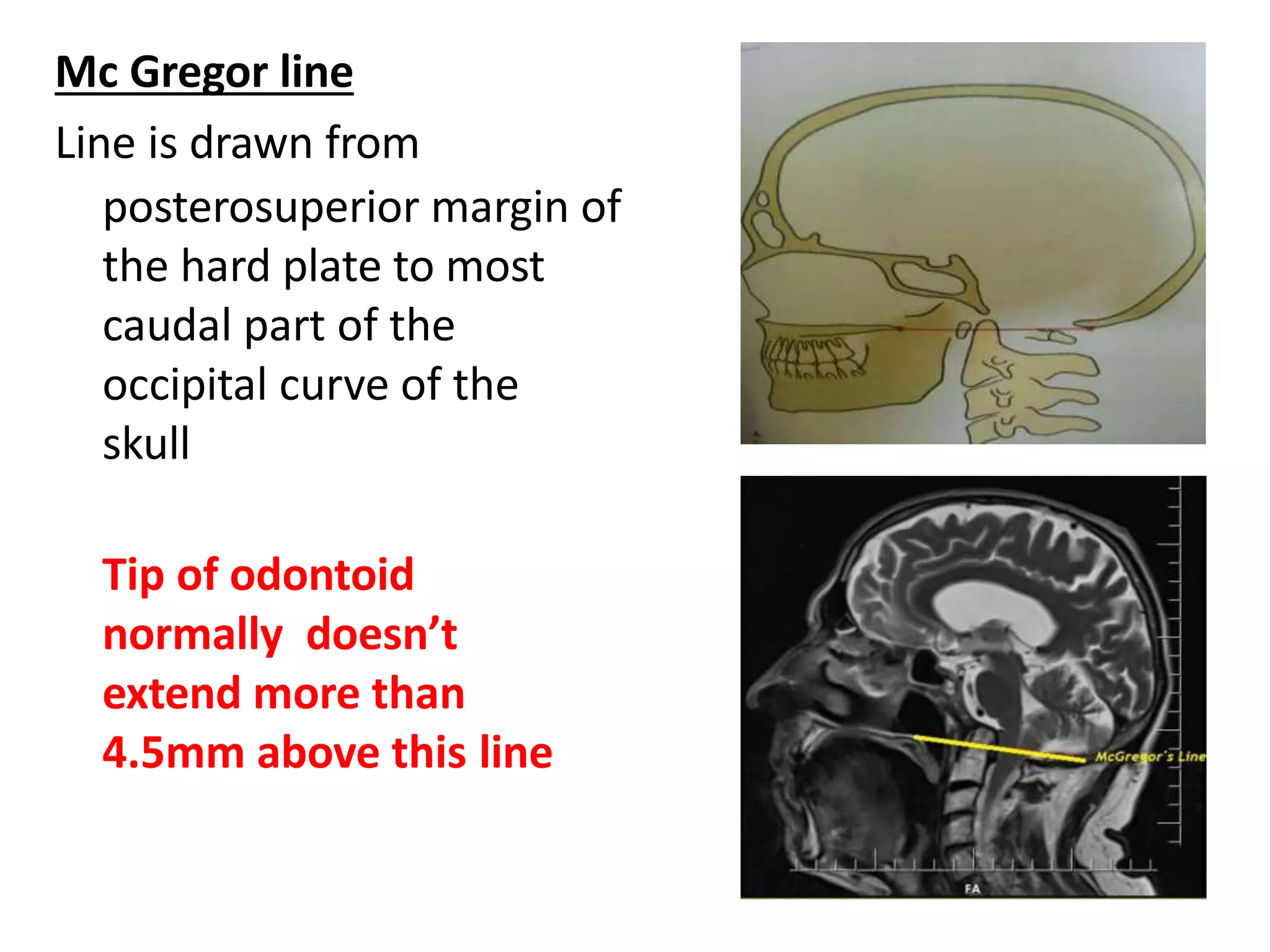 X ray c-spine | PPTX