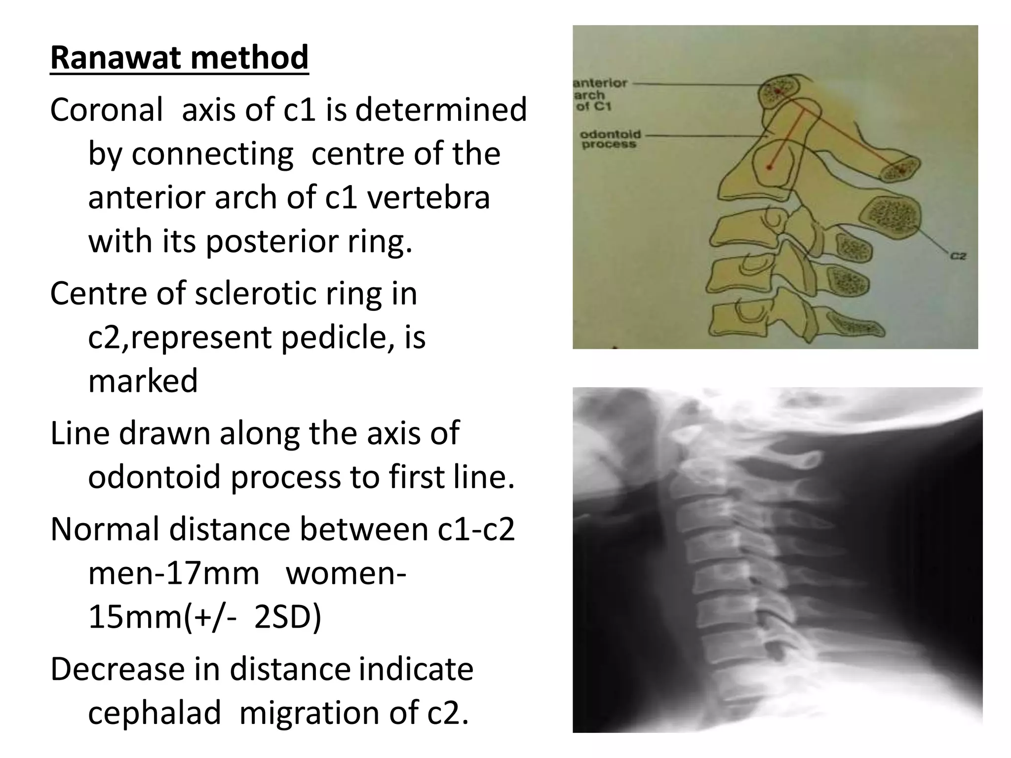 X ray c-spine | PPTX