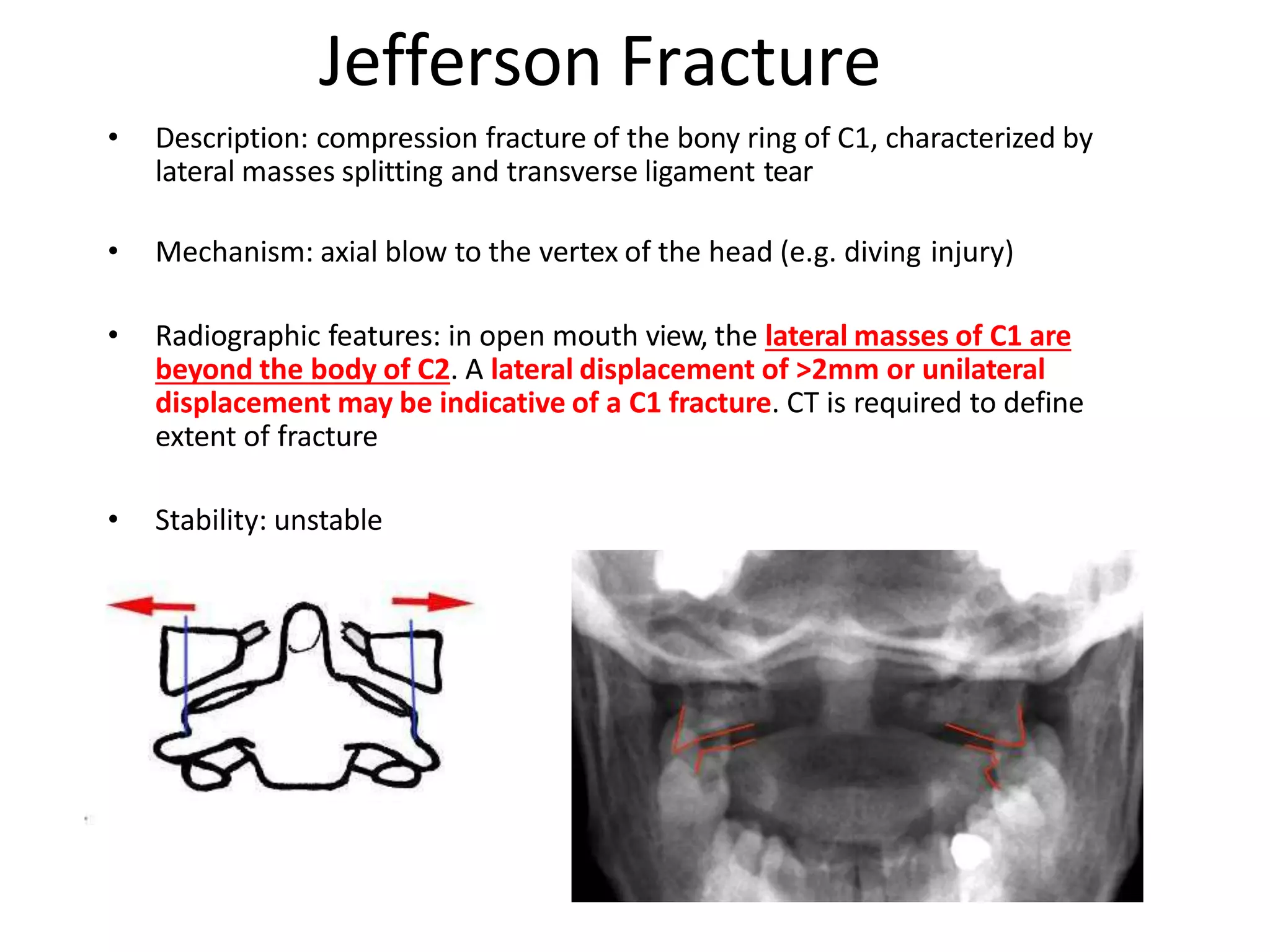 X ray c-spine | PPTX