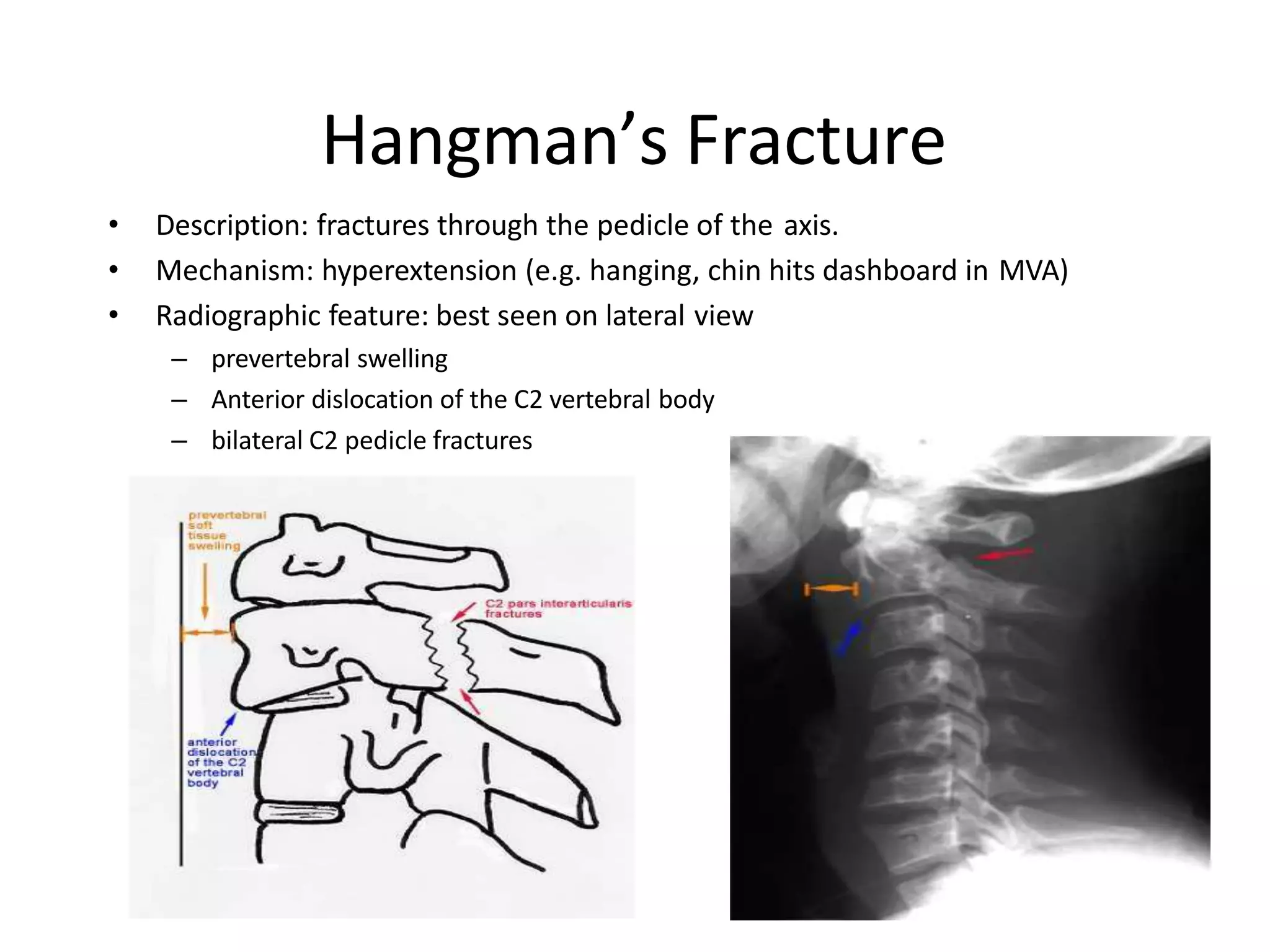 X ray c-spine | PPTX