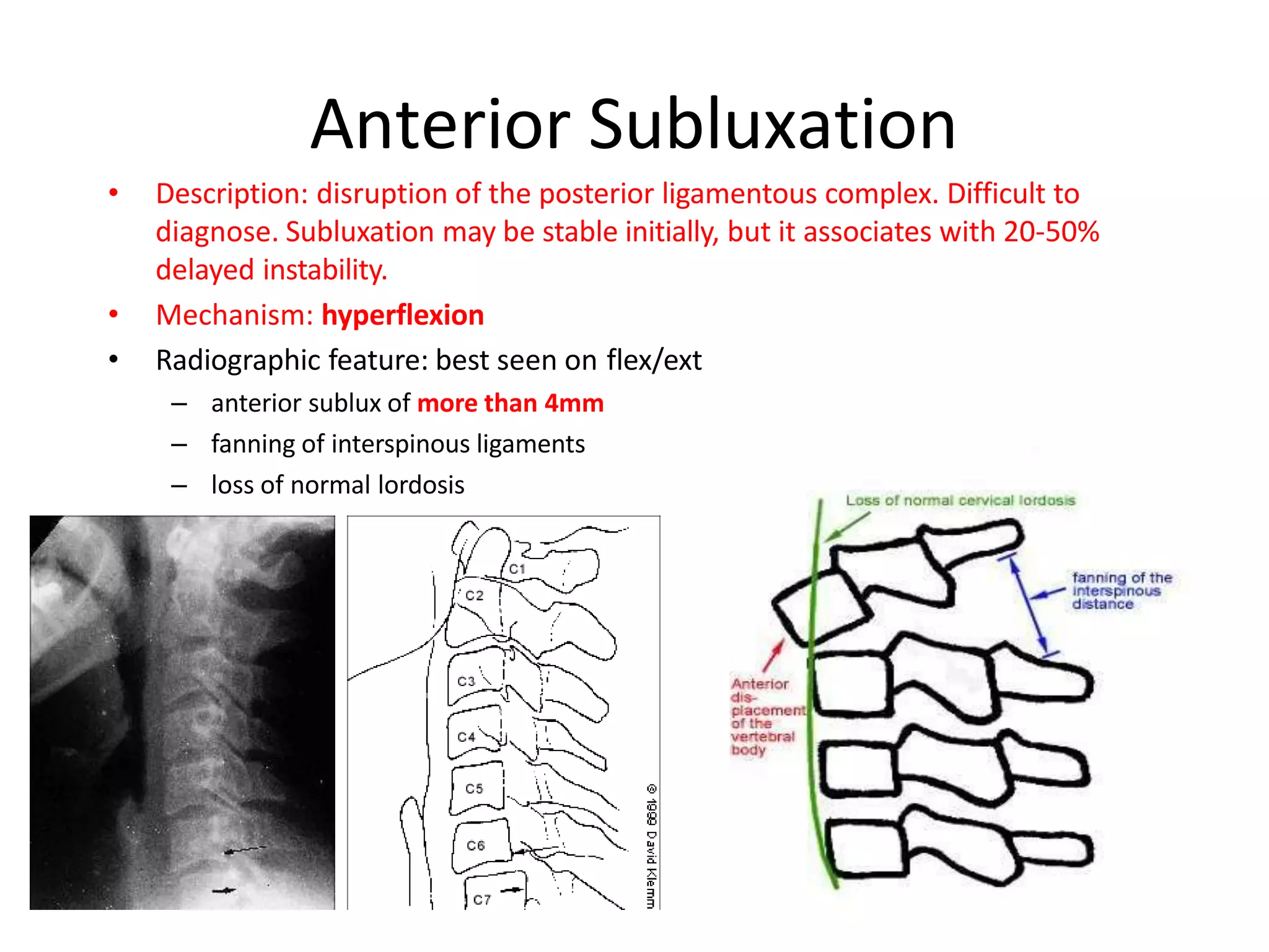 X ray c-spine | PPTX