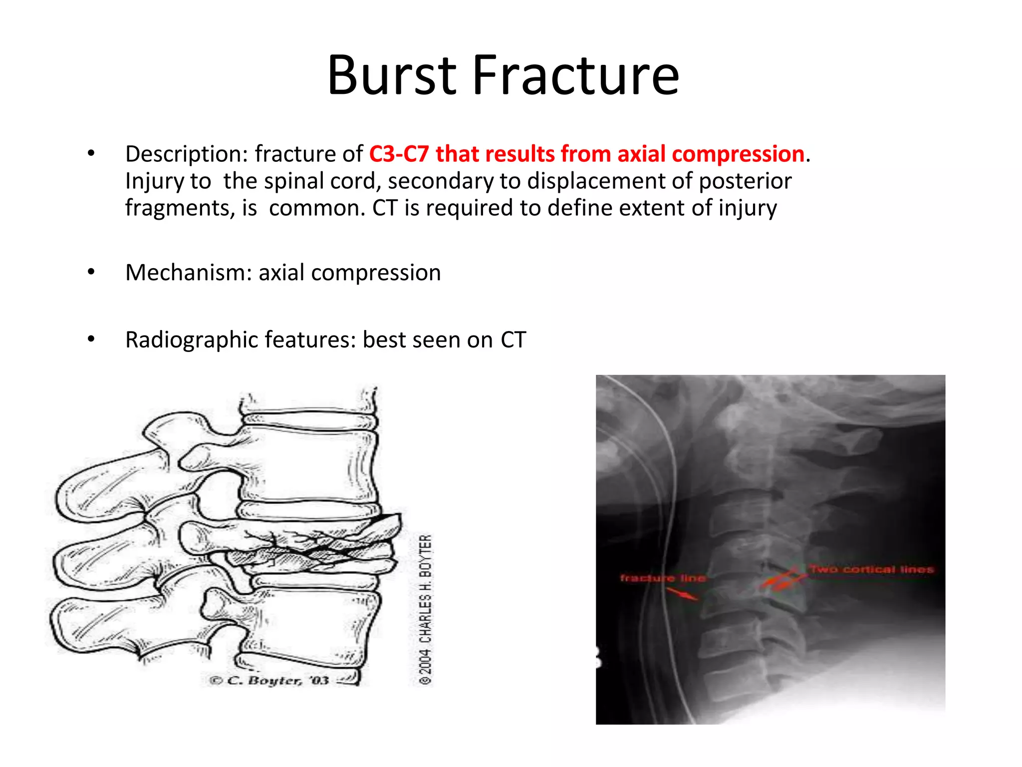 X ray c-spine | PPTX