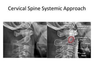 X ray c-spine | PPTX