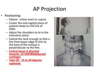 X ray c-spine | PPTX
