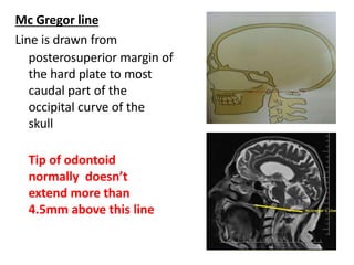 X ray c-spine | PPTX