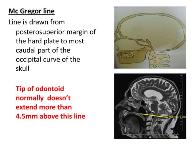 X ray c-spine | PPTX