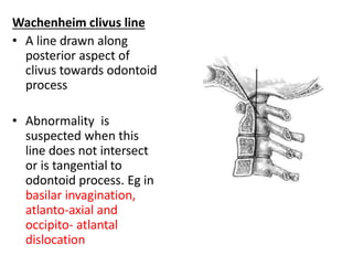 X ray c-spine | PPTX