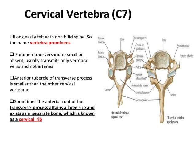 X ray c-spine | PPTX