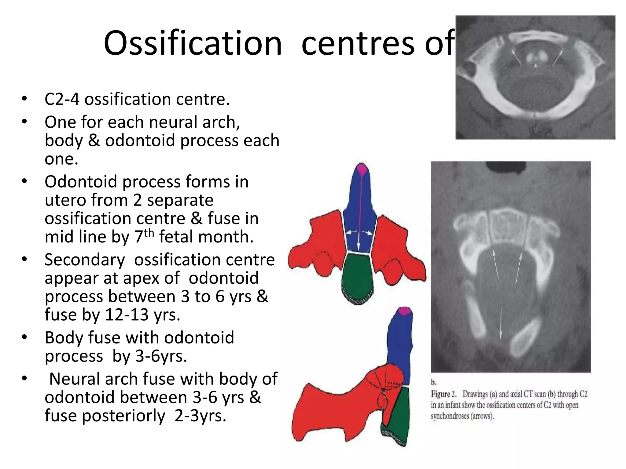 X ray c-spine | PPTX